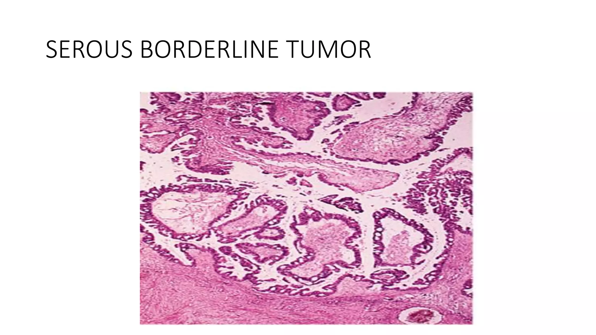 P 9 male and female genital tract disorders | PPTX