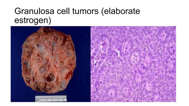 P 9 male and female genital tract disorders | PPT