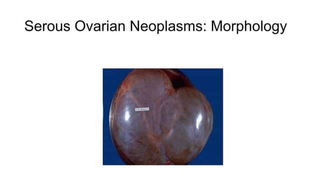 P 9 male and female genital tract disorders | PPT