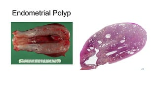P 9 male and female genital tract disorders | PPT