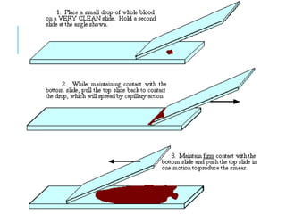 PA13.2_practicals peripheral smear .pptx