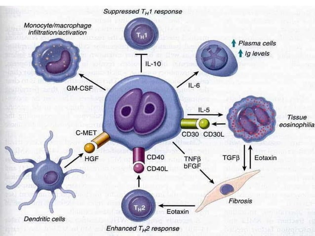 HODGKIN LYMPHOMA - DEFINITION, PATHOGENESIS & PATHOLOGY | PPT | Blood Disorders | Diseases and ...