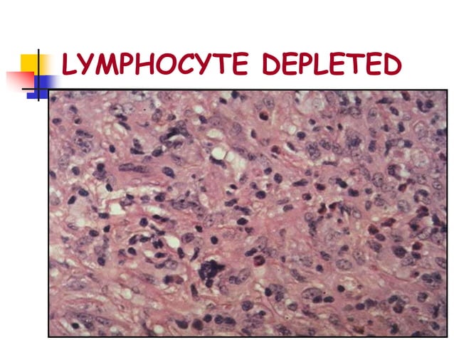 HODGKIN LYMPHOMA - DEFINITION, PATHOGENESIS & PATHOLOGY | PPT | Blood Disorders | Diseases and ...