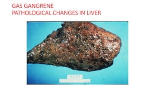 GANGRENE | PDF
