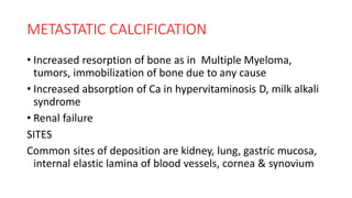Examples Of Metastatic Calcification – NOSXAT
