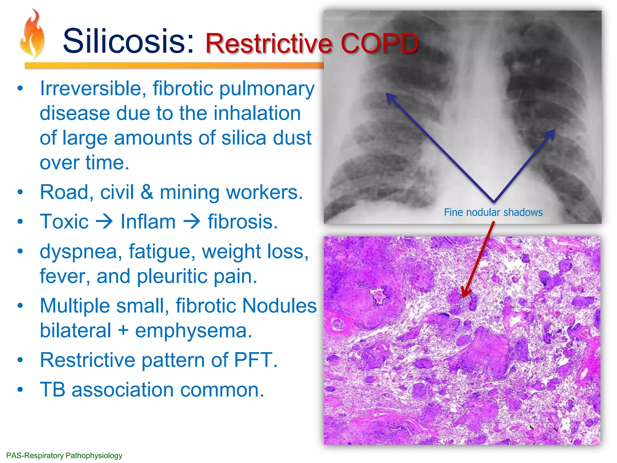 Pathology of Respiratory System Disorders | PPTX