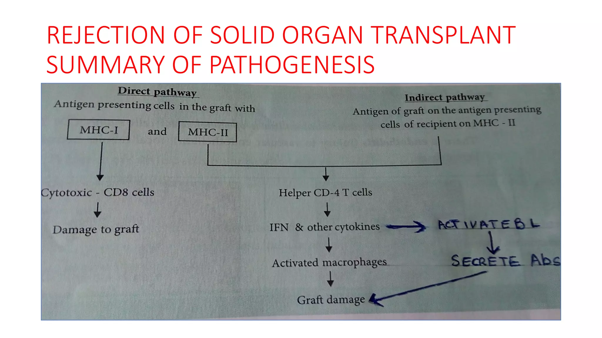 TRANSPLANT REJECTION - TYPES & MECHANISM | PDF