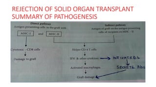 TRANSPLANT REJECTION - TYPES & MECHANISM | PDF