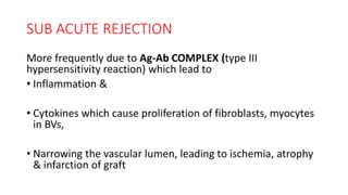 TRANSPLANT REJECTION - TYPES & MECHANISM | PDF