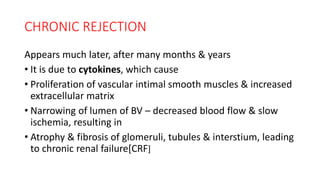 TRANSPLANT REJECTION - TYPES & MECHANISM | PDF