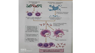 AUTOIMMUNITY PART 2 SYSTEMIC LUPUS ERYTHEMATOSUS | PDF | Blood ...