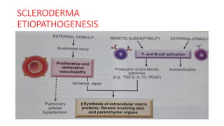 AUTOIMMUNITY PART 3 SJOGREN'S SYNDROME & SCLERODERMA | PPT