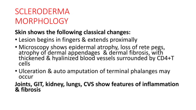 AUTOIMMUNITY PART 3 SJOGREN'S SYNDROME & SCLERODERMA | PPT
