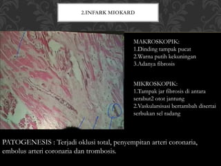 PA Aterosklerosis IDK for fakultas kedokteran | PPT