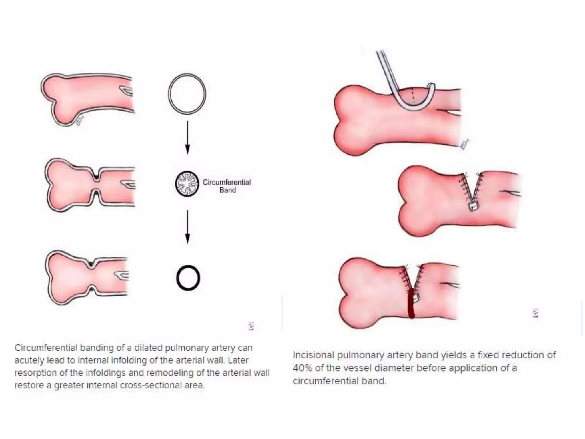 Pa banding new | PPTX