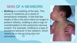 Immediate Newborn Care and Characteristics of a Newborn | PPT