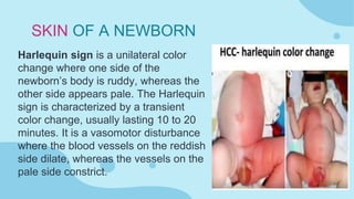 Immediate Newborn Care and Characteristics of a Newborn | PPT