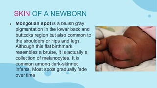 Immediate Newborn Care and Characteristics of a Newborn | PPT