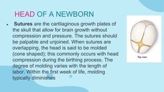 Immediate Newborn Care and Characteristics of a Newborn | PPT