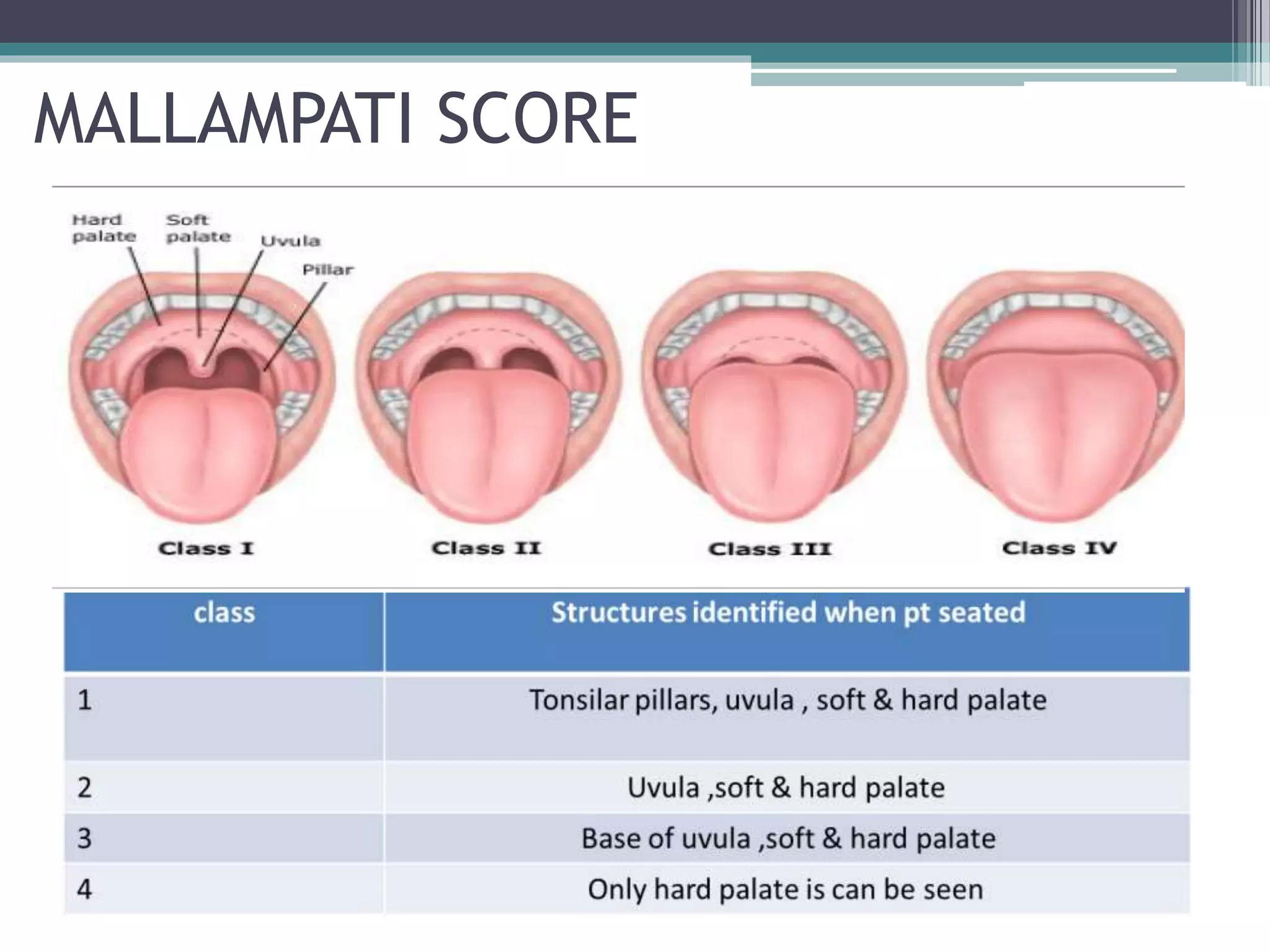 Preanesthetic Assessment | PPTX