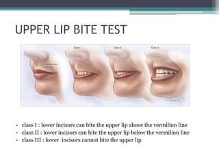 Upper Lip Bite Test
