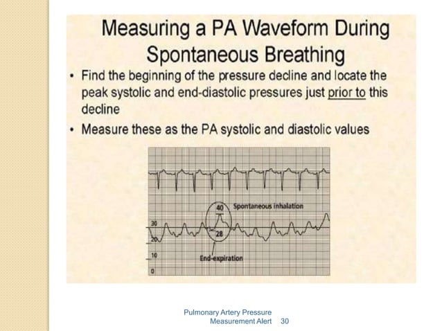 Pa catheter ctvac | PPTX | Heart and Cardiovascular Diseases | Diseases ...