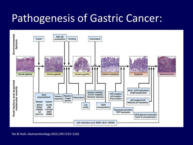 Gastric cancer: From Molecular Classification to Clinical Impact | PPT