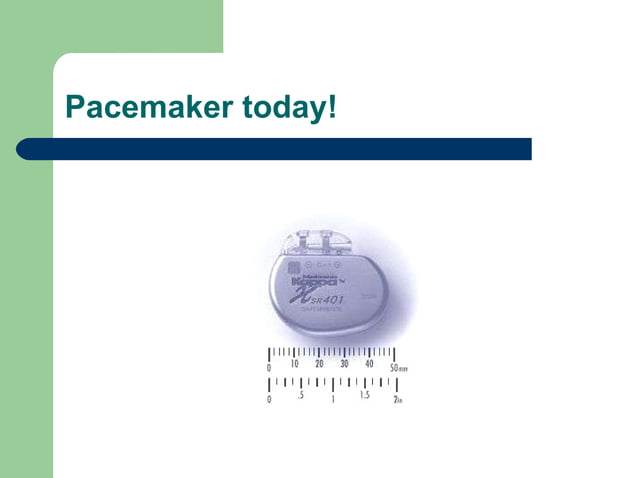Pacemaker and anaesthesia | PPT | Heart and Cardiovascular Diseases ...