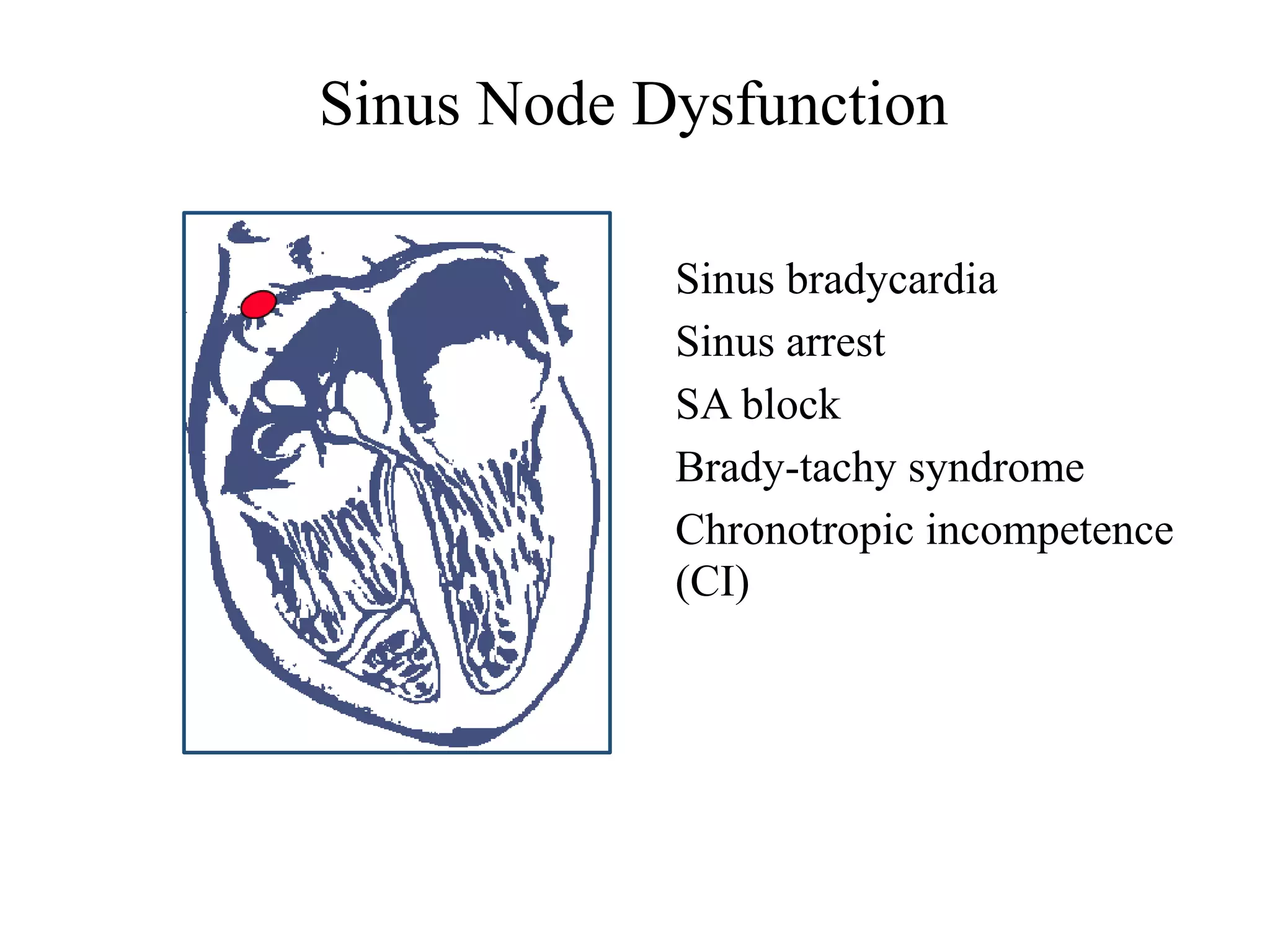 Artificial Cardiac Pacemaker | PPTX
