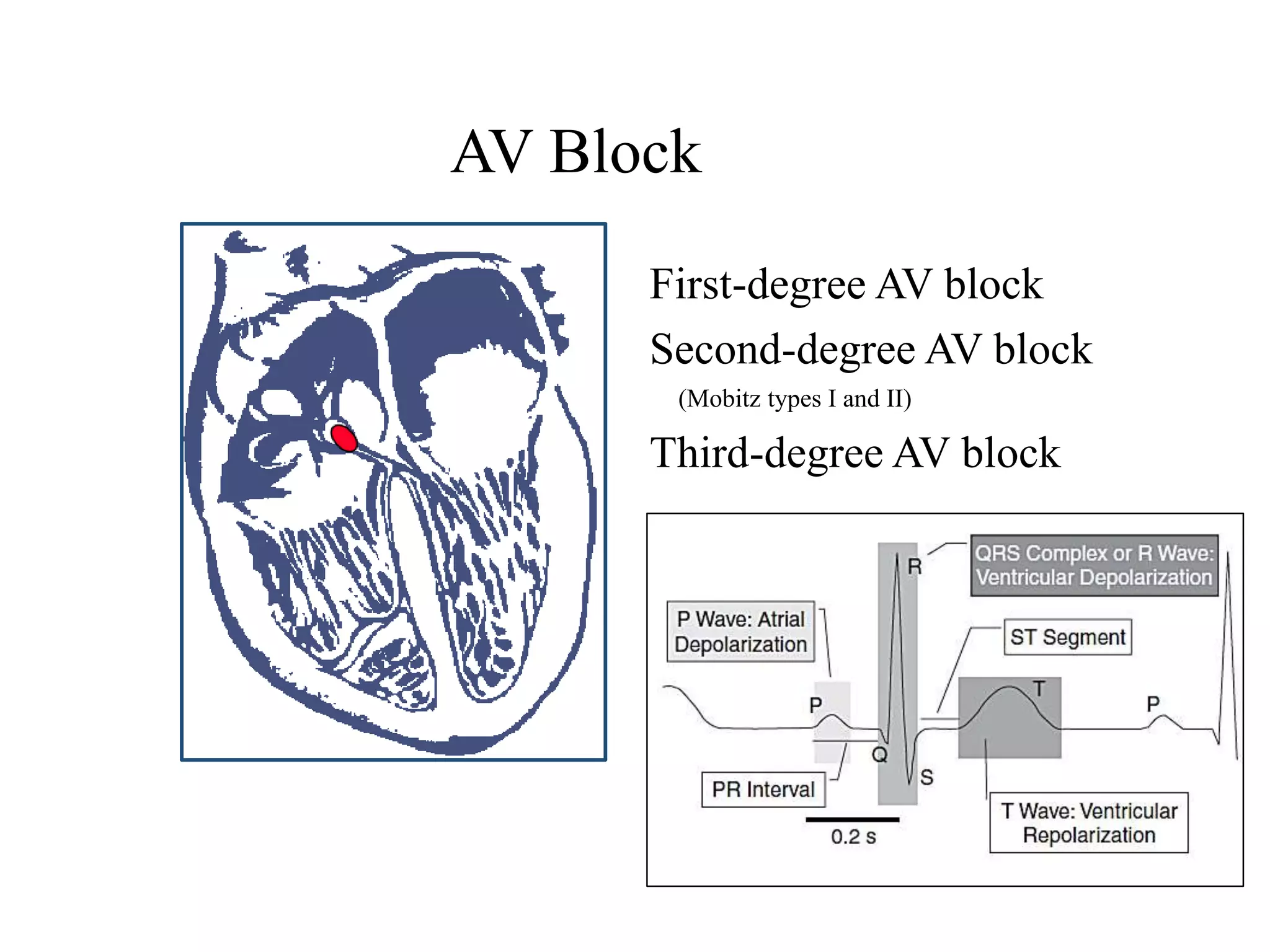 Artificial Cardiac Pacemaker | PPTX