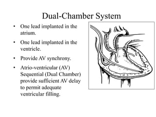 Artificial Cardiac Pacemaker | PPTX