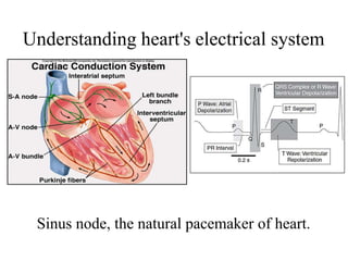 Artificial Cardiac Pacemaker | PPTX