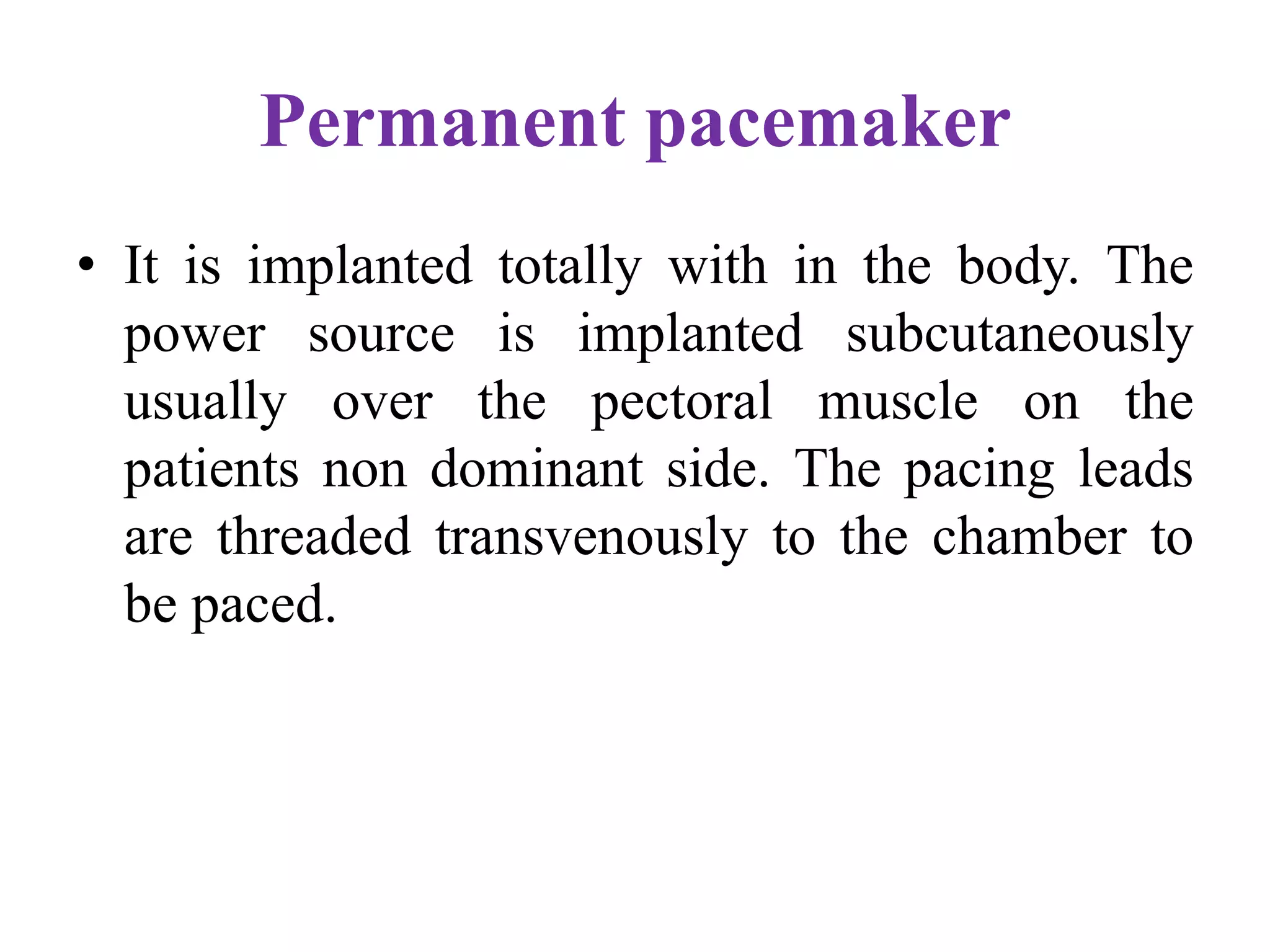 Pacemaker | PPSX