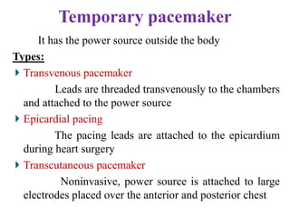 Pacemaker | PPSX