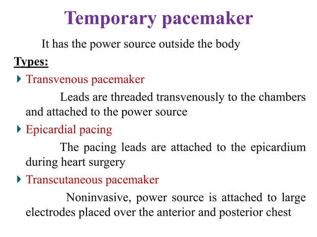Pacemaker | PPSX