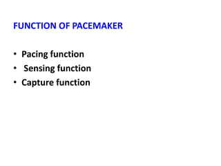 Pacemaker | PPSX
