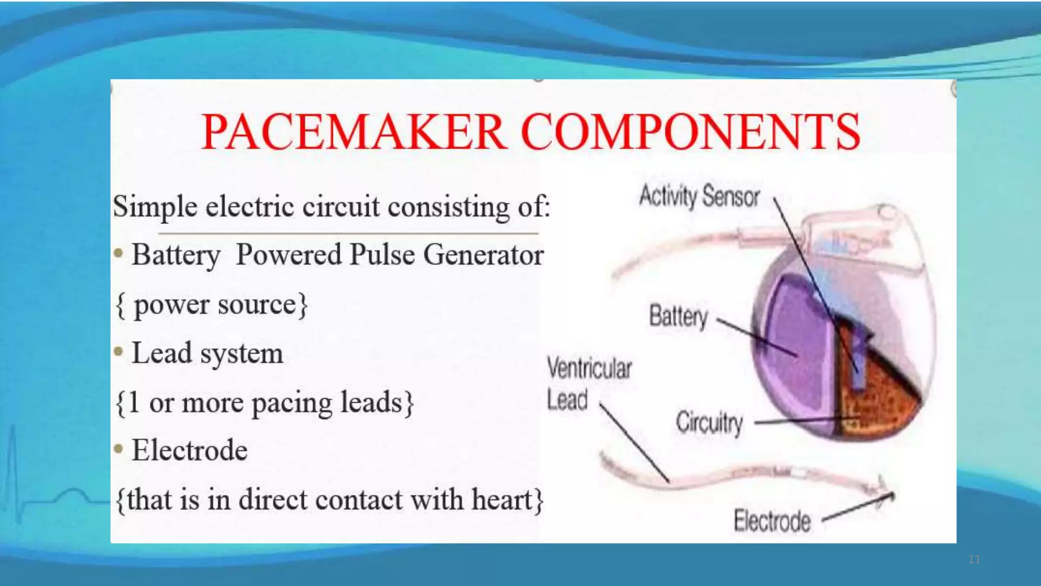 Pacemaker | PPTX