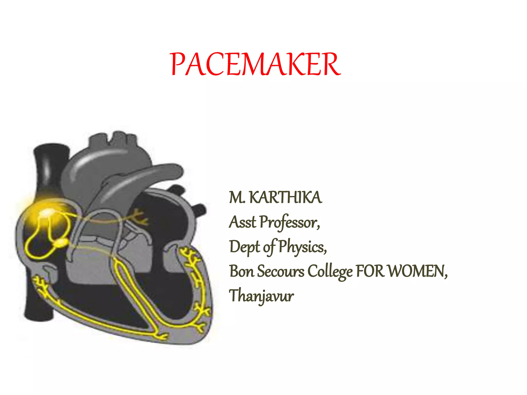 Pacemaker | PPT