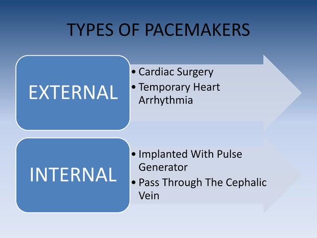 Pacemaker | PPT