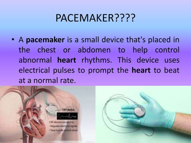 Pacemaker | PPT