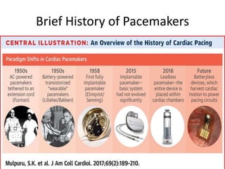 Pacemaker | PPT