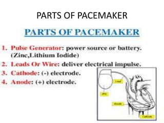 Pacemaker | PPT