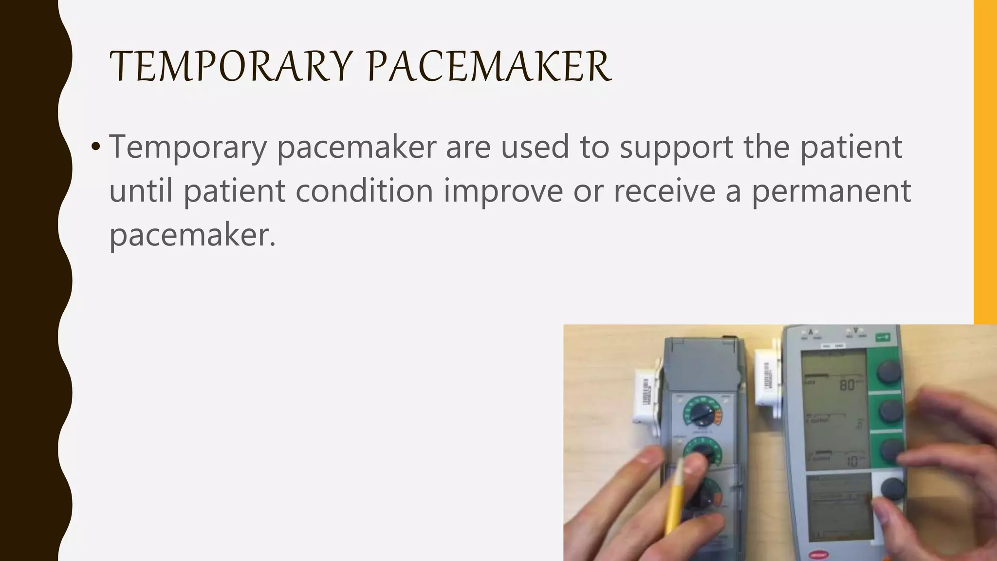 Pacemaker | PPTX