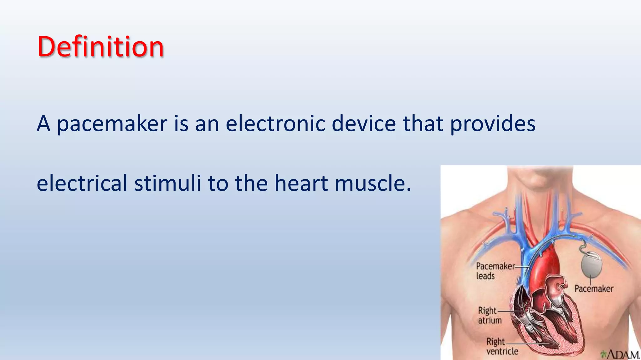 Pacemaker | PPTX