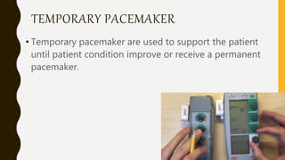 Pacemaker | PPTX