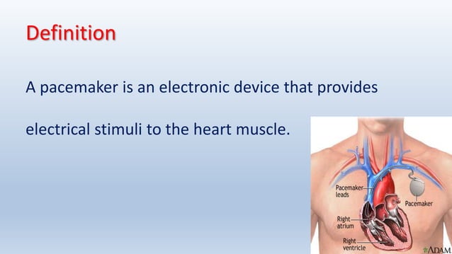 Pacemaker | PPTX