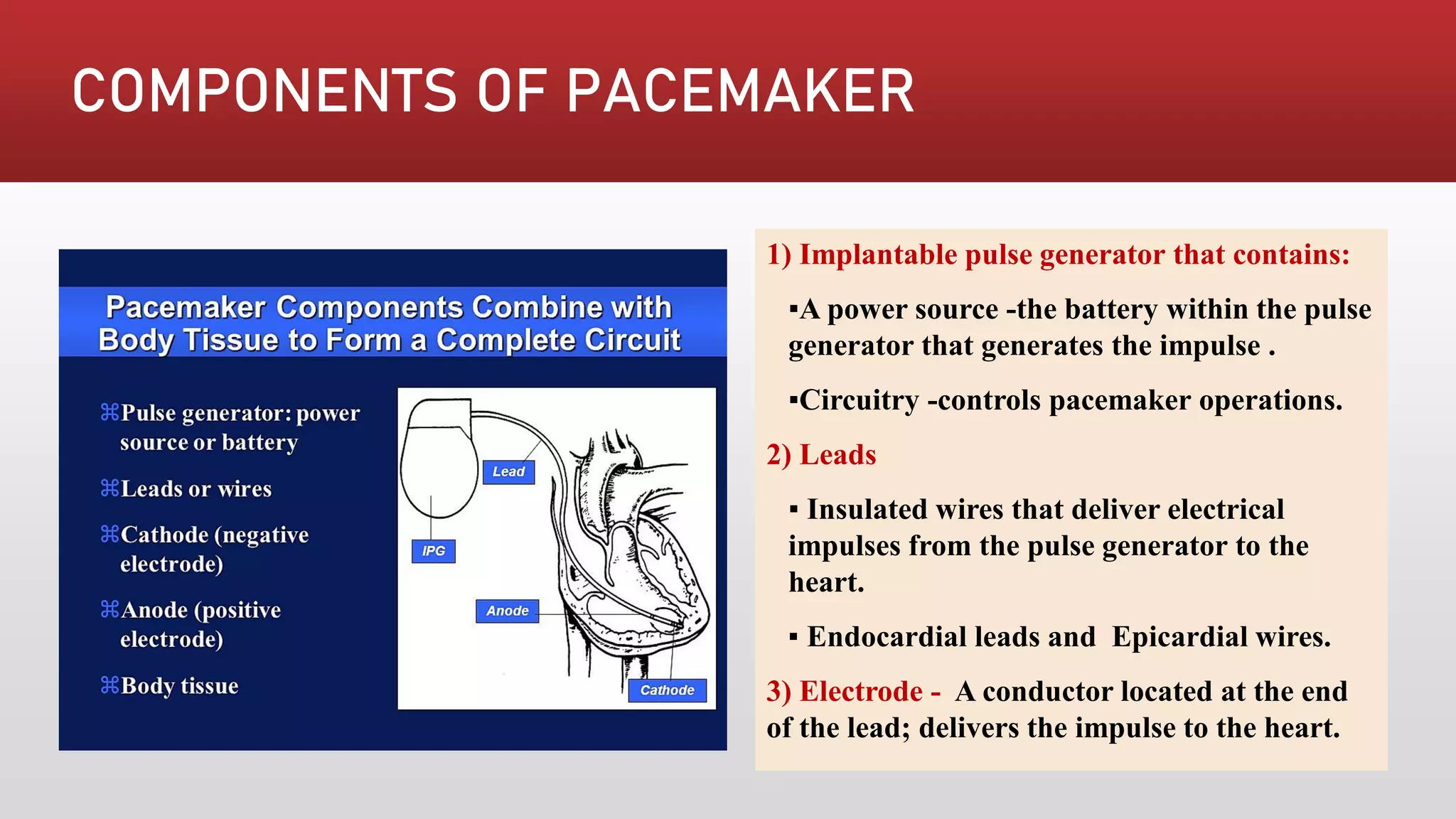 PACEMAKER | PDF
