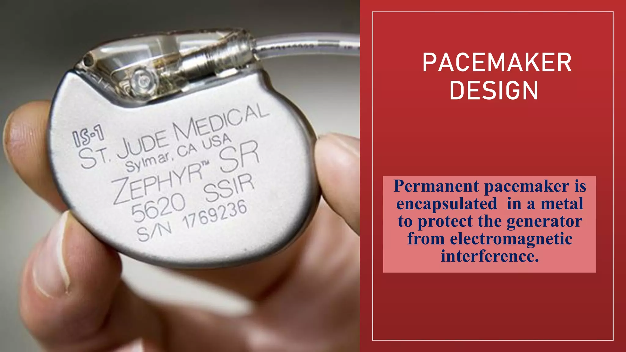 PACEMAKER | PDF