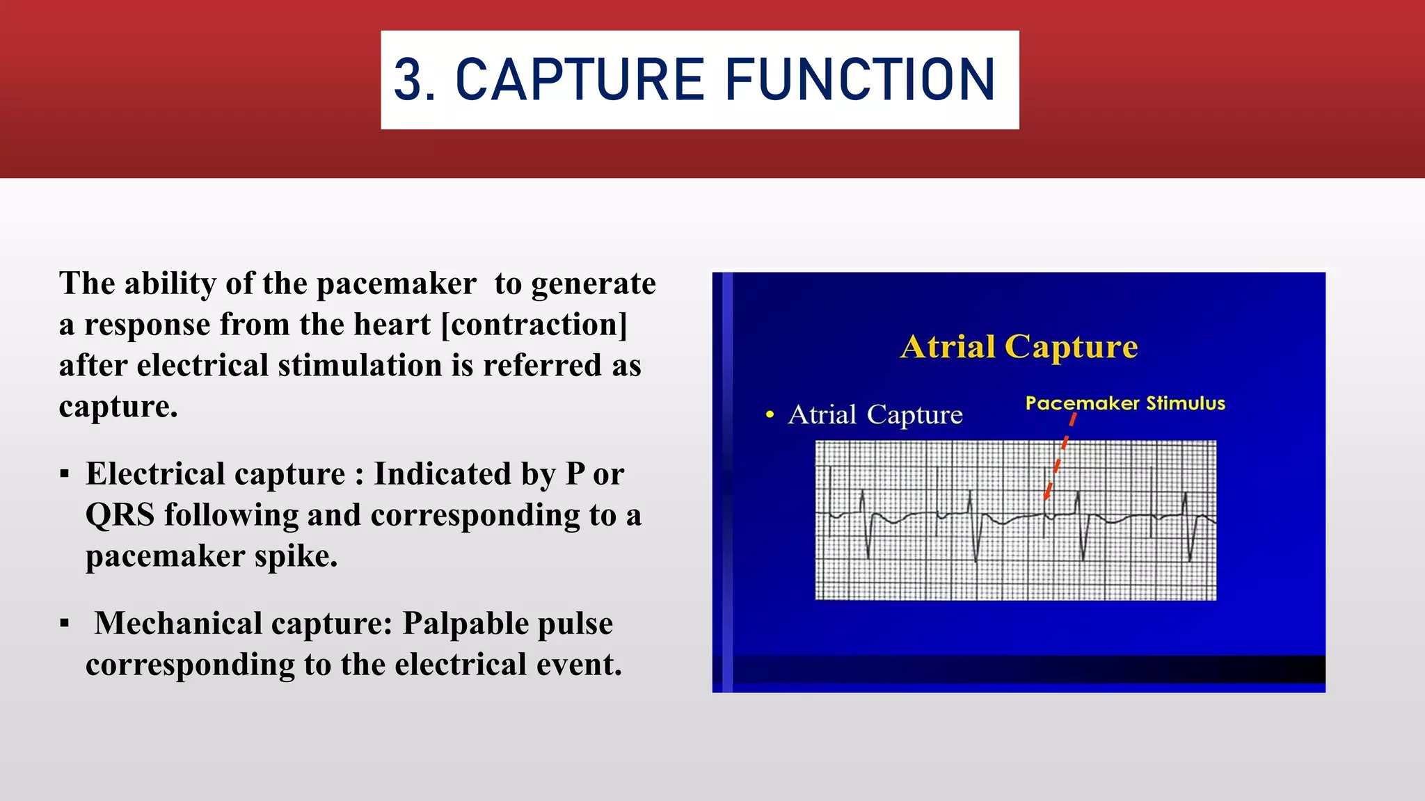 PACEMAKER | PDF