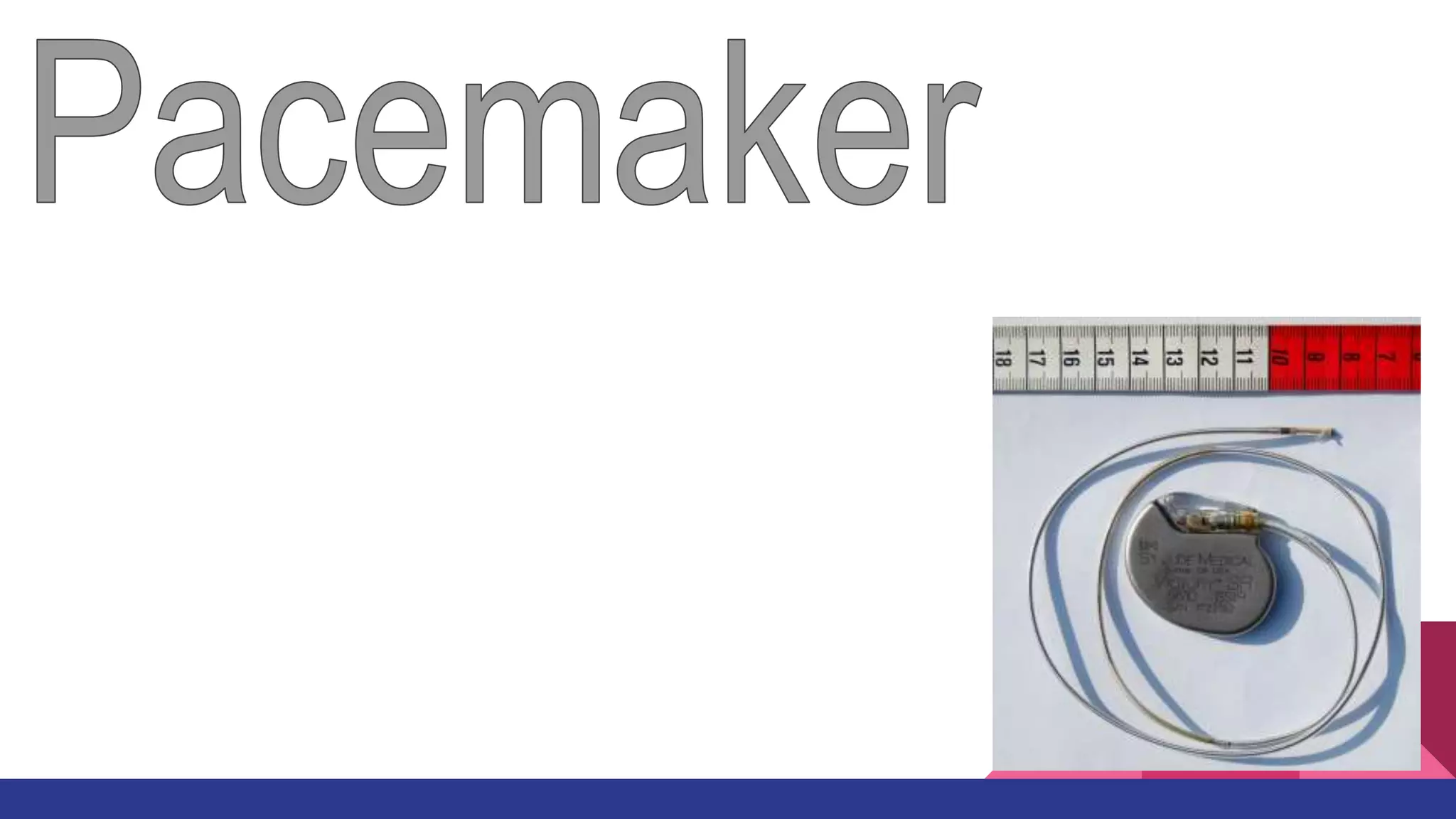 Pacemaker - Basic Information | PPT